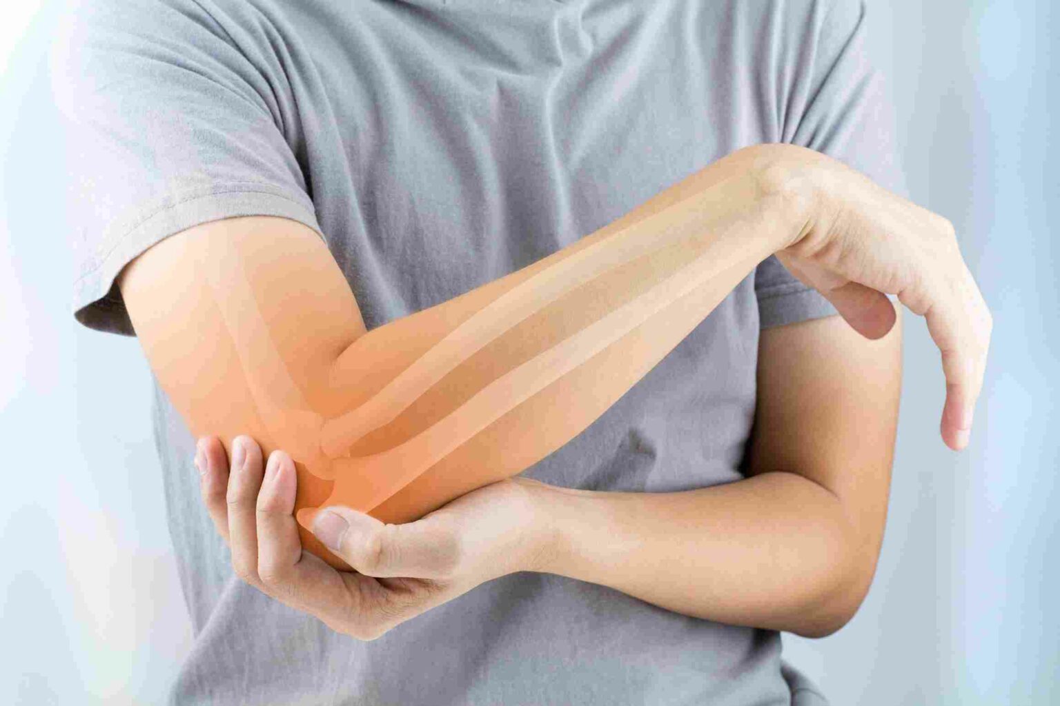 Olecranon Bursitis: What Is It, Causes, Treatment And More