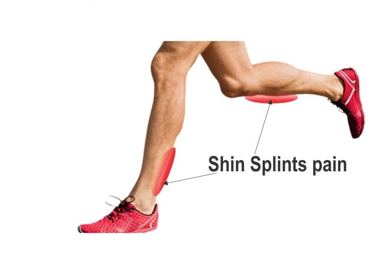 Physical Therapy For Shin Splints: How It Works And Exercises