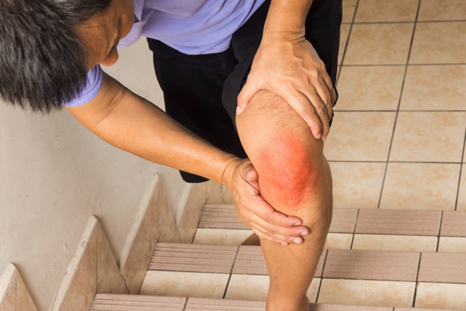 Rheumatoid Arthritis in the Knee: Causes and Treatment Methods