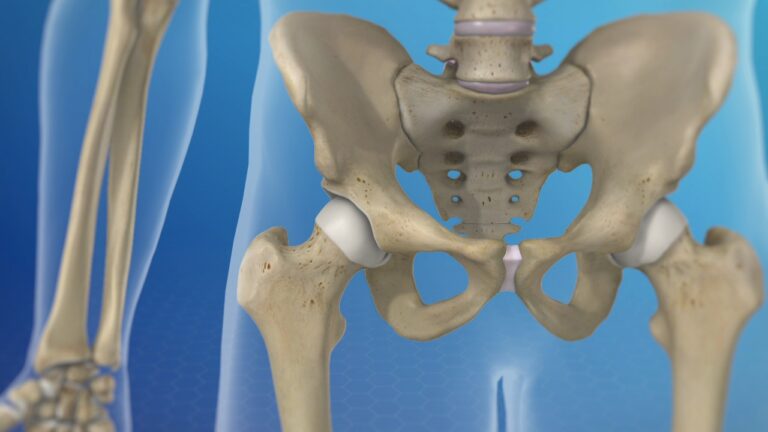 Hip Ball and Socket Joint Problems: Treatment Methods of It