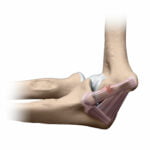 Tommy John's Pain: What Is It, Causes And Treatment Tips