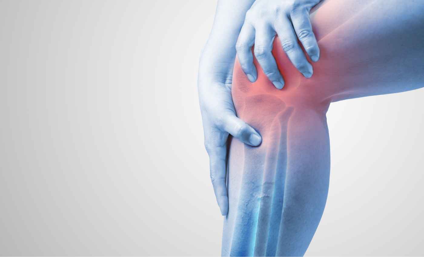 How to Manage Patellofemoral Pain Syndrome?